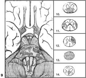 Jean-Martin Charcot • LITFL • Medical Eponym Library
