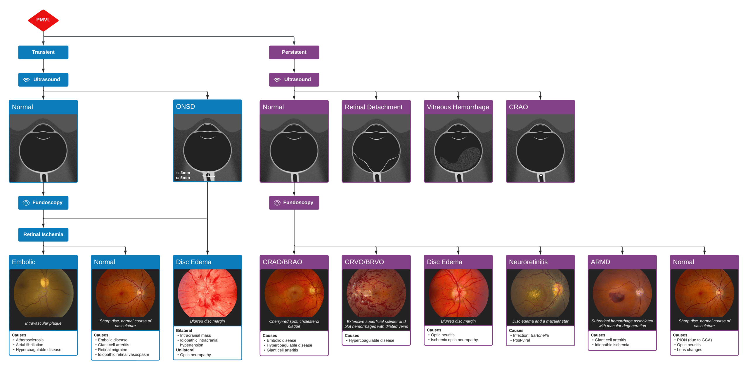 Loss of vision DDx • LITFL • CCC Differential Diagnosis