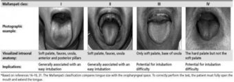 Airway Assessment • LITFL Medical Blog • CCC Airway