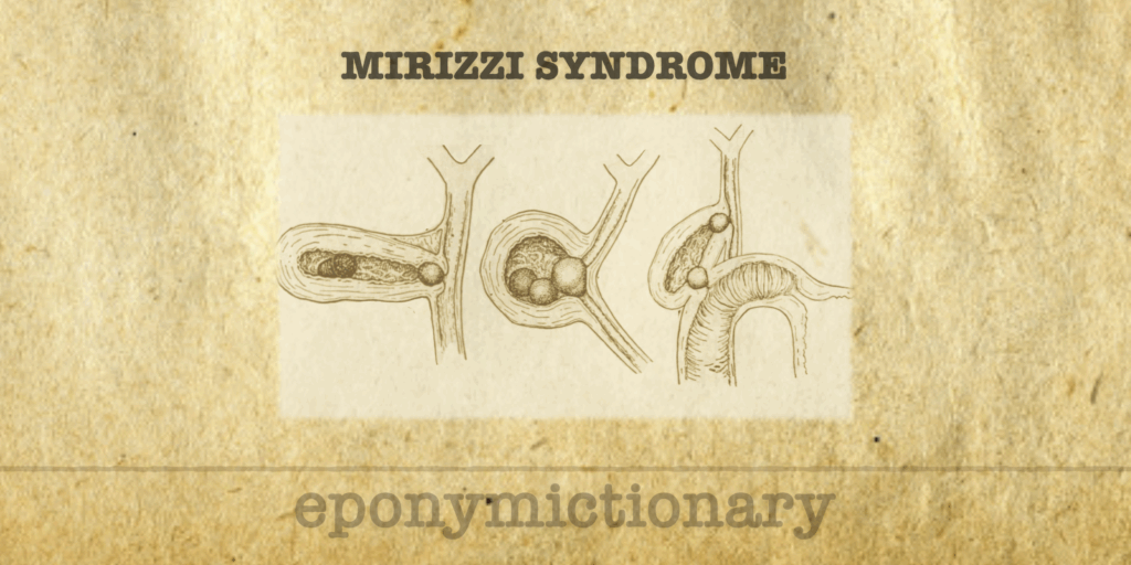 Mirizzi syndrome • LITFL Medical Blog • Medical Eponym Library