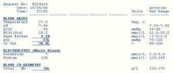 Dissociated Oxygen Saturations • LITFL • Hematology Hoodwinker