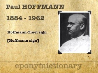 Hoffmann-Tinel sign Archives • LITFL