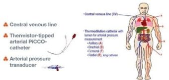 PiCCO • LITFL • CCC Equipment