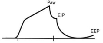 Pulmonary mechanics • LITFL • CCC Ventilation