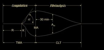 Thromboelastogram (TEG) • LITFL • CCC Investigations
