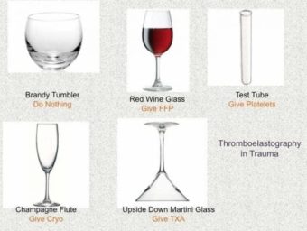 Thromboelastogram (TEG) • LITFL • CCC Investigations