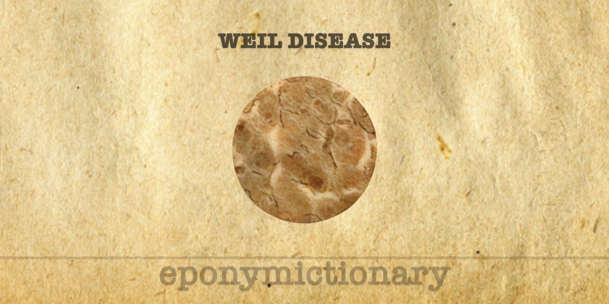 Weil disease • LITFL • Medical Eponym Library