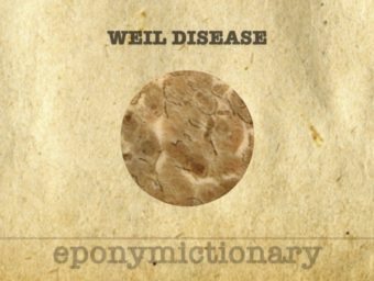 Weil disease Archives • LITFL