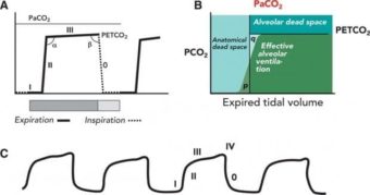 Capnography Waveform Interpretation • LITFL • CCC Equipment