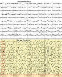 Pediatrics Archives • Page 2 of 11 • LITFL