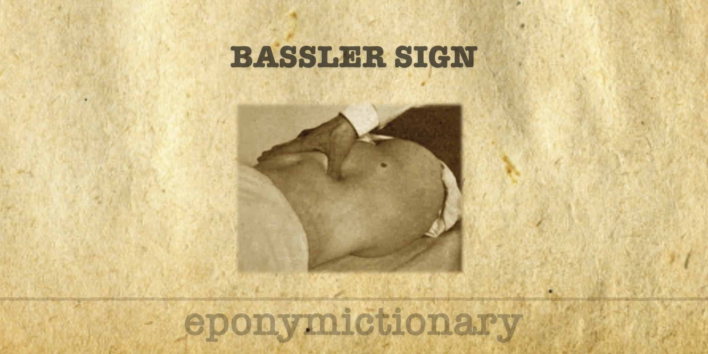 Bassler Sign • LITFL • Medical Eponym Library