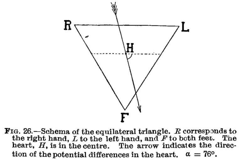 History of the Electrocardiogram • LITFL • Medical Eponym Library