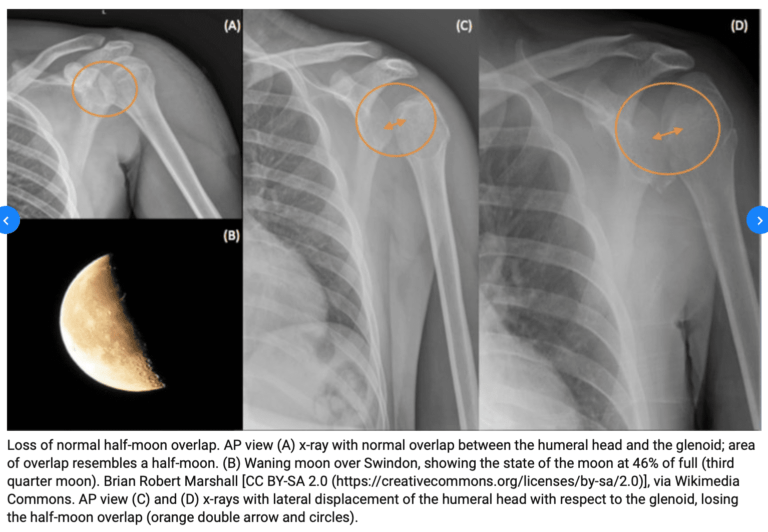 Funtabulously Frivolous Friday Five 271 • LITFL