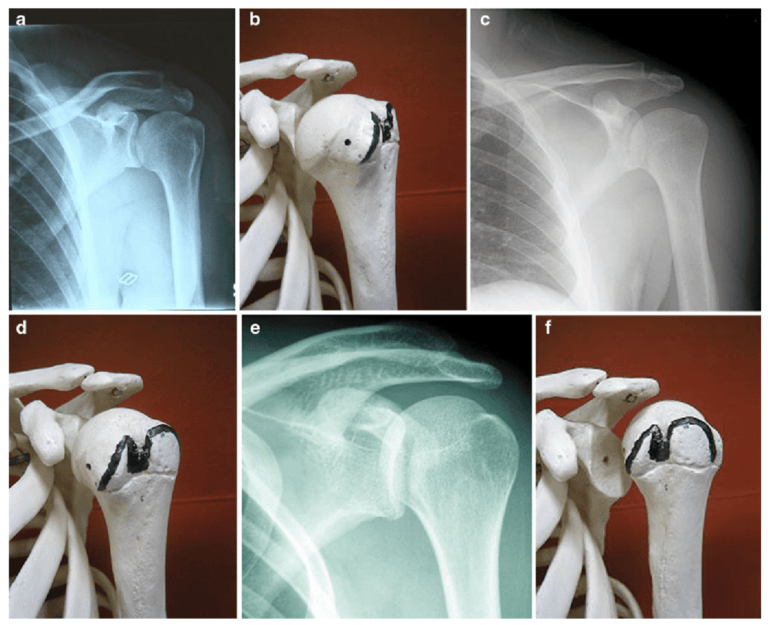 Funtabulously Frivolous Friday Five 271 • LITFL