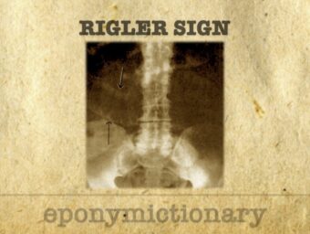 Double Wall Sign Archives • LITFL