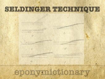 Seldinger Technique Archives • LITFL