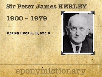 Peter James Kerley Archives • LITFL