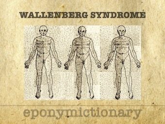 Wallenberg Syndrome Archives • LITFL