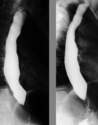 Funtabulously Frivolous Friday Five 172 • LITFL • FFFF