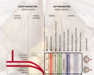 The rule of 4 of the brainstem • LITFL • Neurology