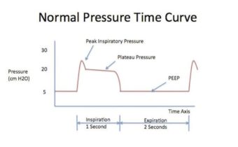Pressure versus Time Graph • LITFL