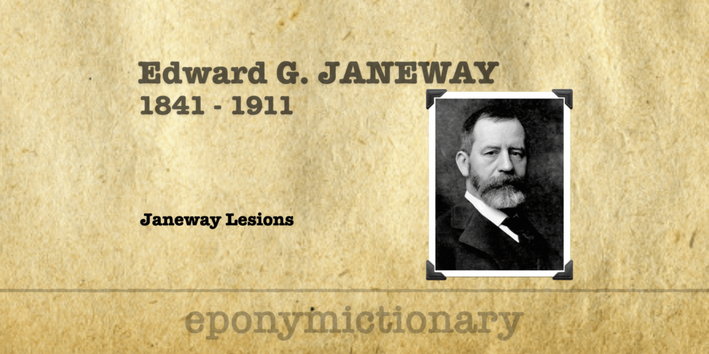 Edward Janeway • LITFL • Medical Eponym Library