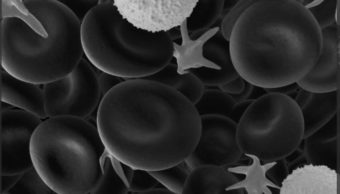 Dissociated Oxygen Saturations • LITFL • Hematology Hoodwinker