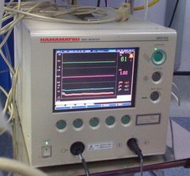 Bullet in the Head • LITFL • Neurological Mind-Boggler