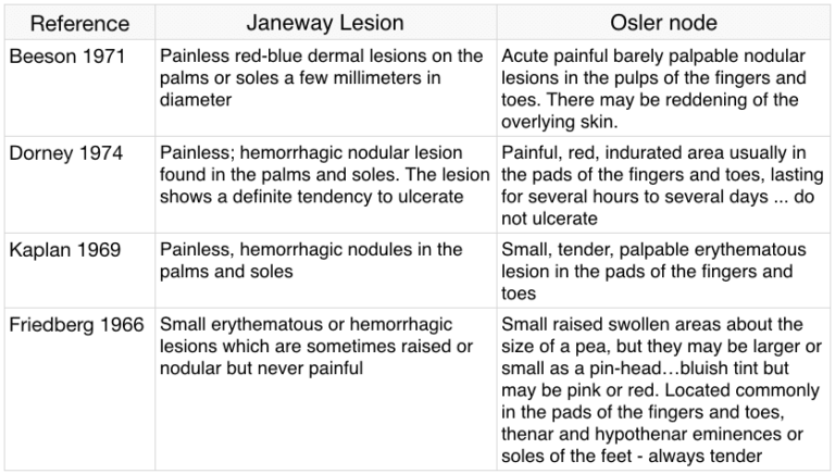 Janeway lesions • LITFL • Medical Eponym Library