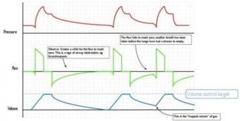 Intrinsic PEEP • LITFL • CCC Ventilation