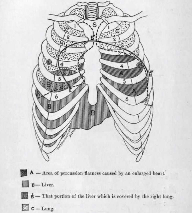Thomas Morgan Rotch • LITFL • Medical Eponym Library