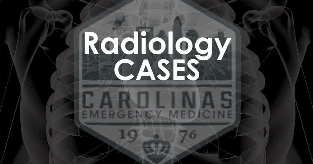 Neuroimaging Cases 010 • LITFL • CMC Radiology