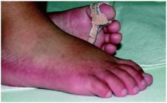 Funtabulously Frivolous Friday Five 218 • LITFL • FFFF