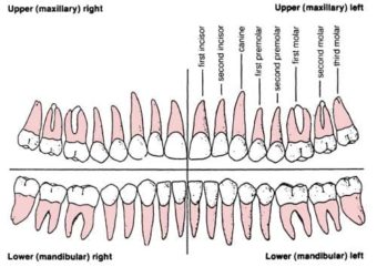 Tooth Avulsion • LITFL • Trauma Library