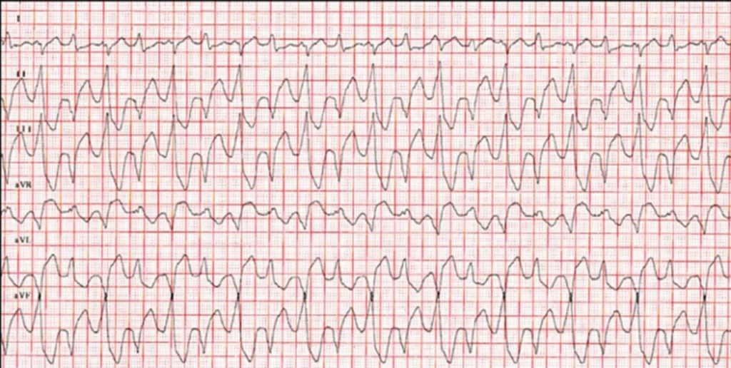 Funtabulously Frivolous Friday Five 302 • LITFL