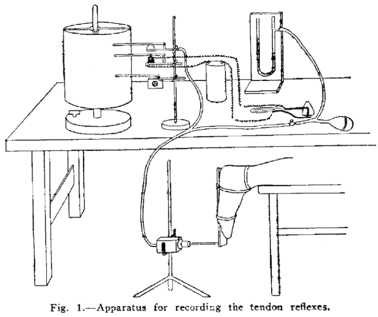 Woltman sign • LITFL • Medical Eponym Library