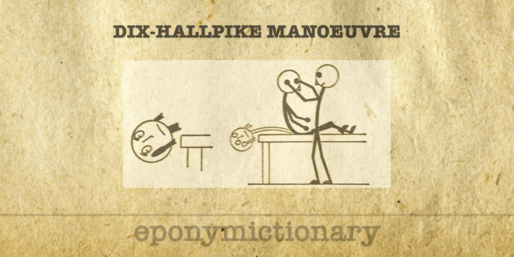 Dix-Hallpike Manoeuvre • LITFL • Medical Eponym Library