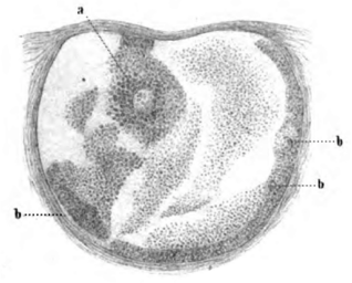 Emma Call • LITFL • Medical Eponym Library