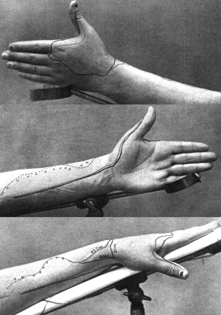 William Rivers • LITFL • Medical Eponym Library