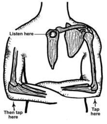 Leopold Auenbrugger • LITFL • Medical Eponym Library