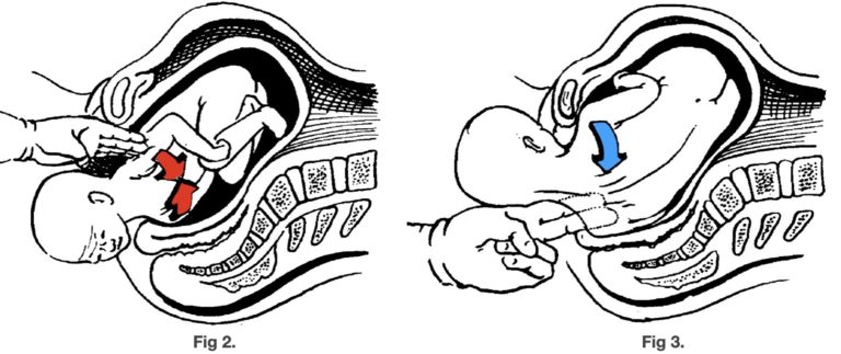 Alan Rubin • LITFL • Medical Eponym Library