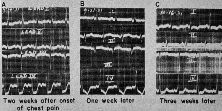 History of the Electrocardiogram • LITFL • Medical Eponym Library