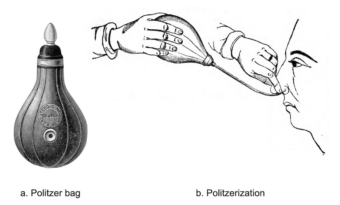 Adam Politzer • LITFL • Medical Eponym Library
