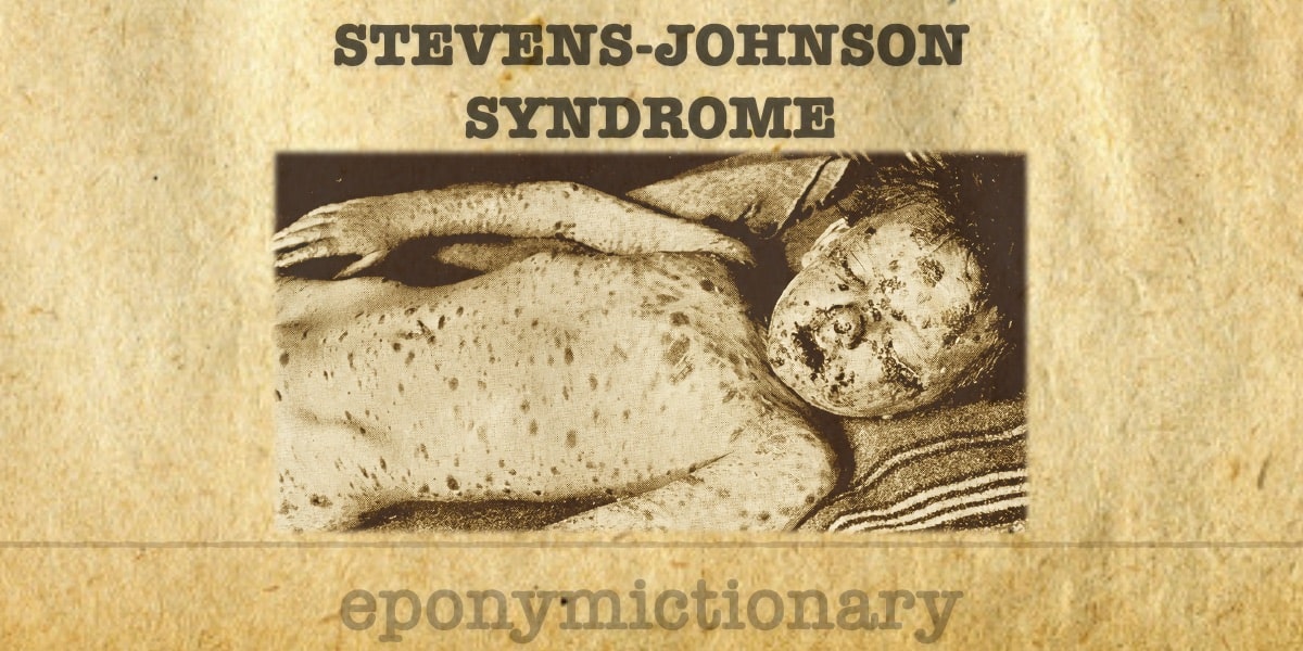 Stevens-Johnson syndrome • LITFL • Medical Eponym Library