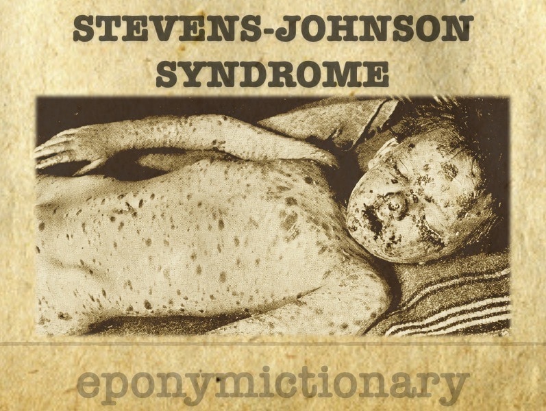 Stevens-Johnson syndrome Archives • LITFL