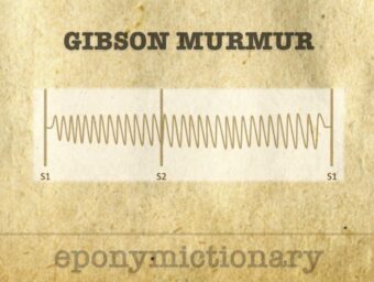 machinery murmur Archives • LITFL