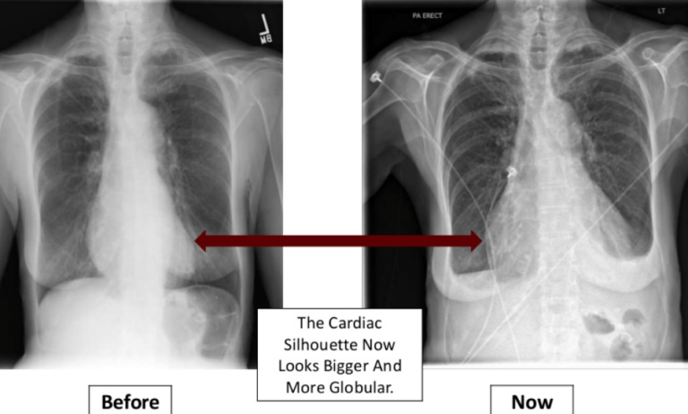 CXR Case 157 • LITFL • Chest X-ray Self-Assessment Quiz