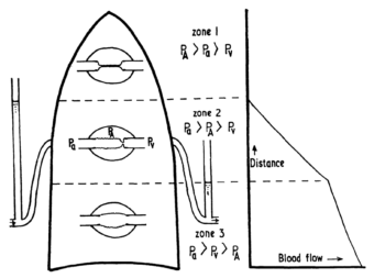 Positive End-Expiratory Pressure (PEEP) • LITFL • CCC Ventilation
