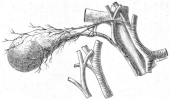 François Calot • LITFL • Medical Eponym Library