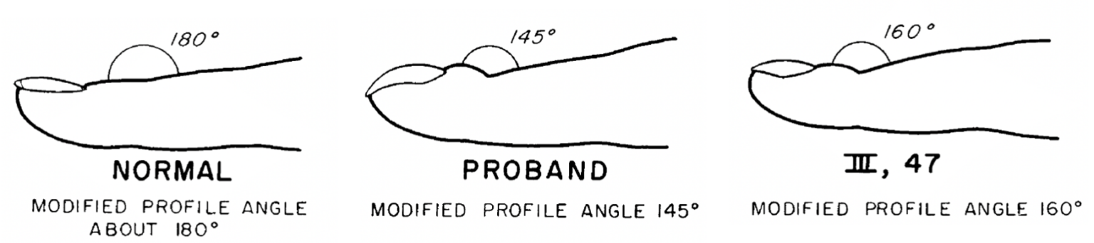 Helene Ollendorff • LITFL • Medical Eponym Library